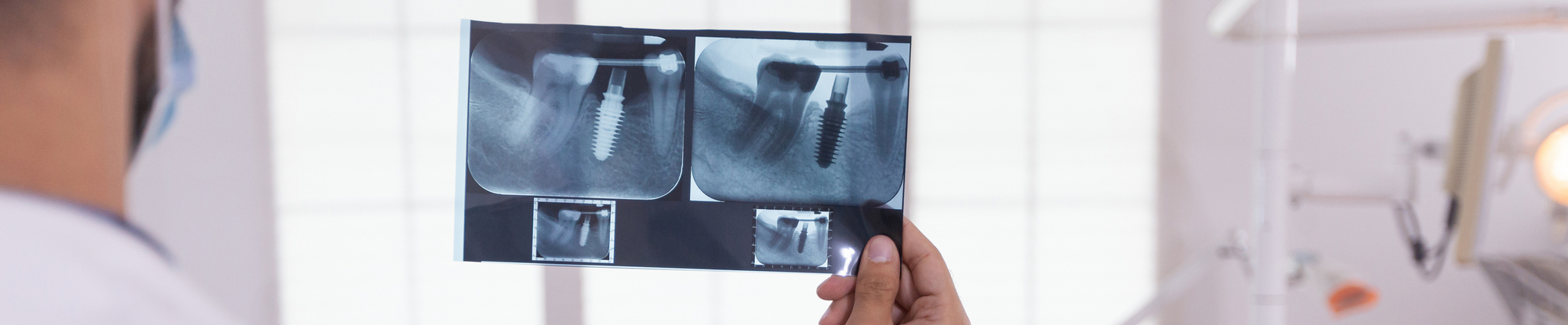 Implantología - Clínica Dr. Luis Lasso